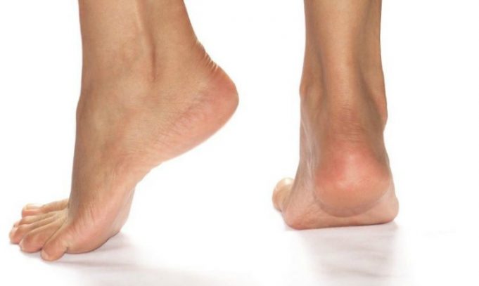 Tiloma plantare: sintomi, cause e rimedi | Vivi Puro